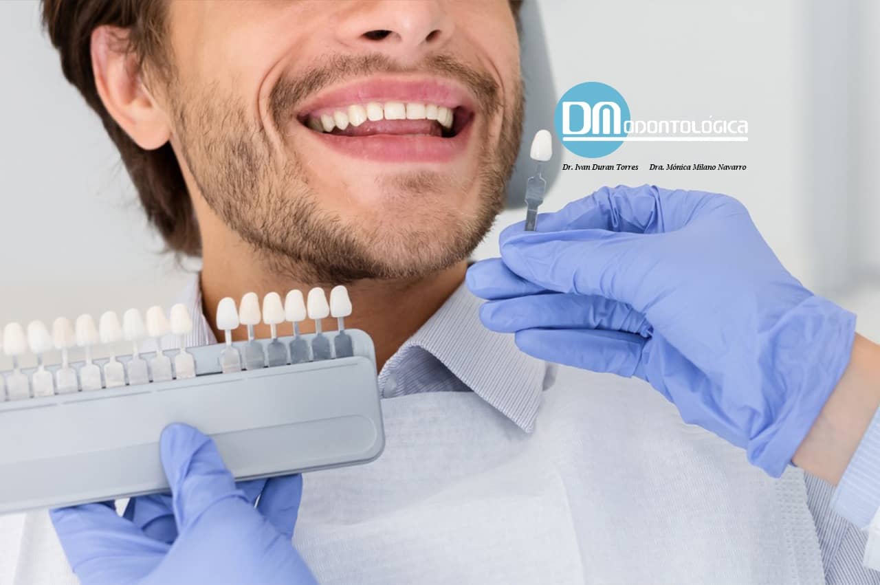 Escala de tonos dentales. – DM Odontológica