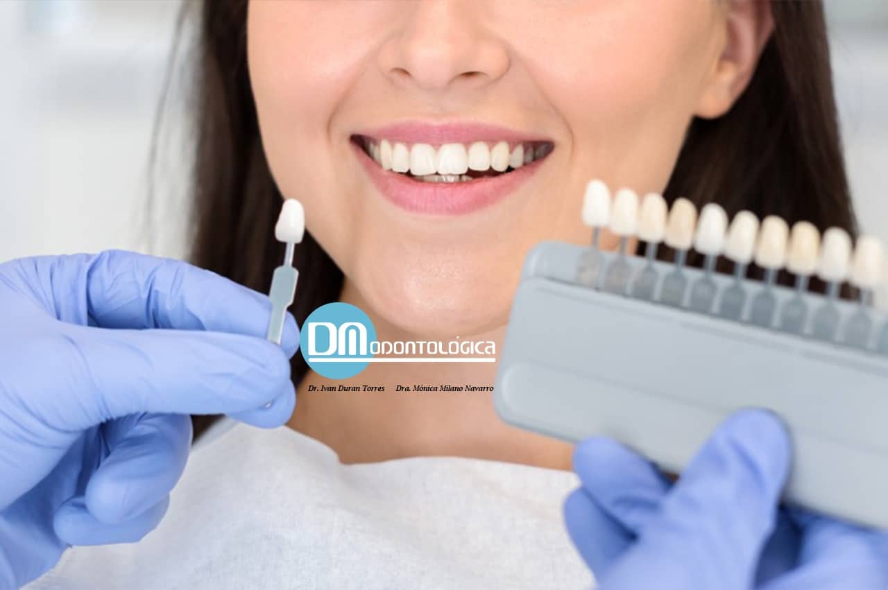 Escala de tonos dentales. – DM Odontológica